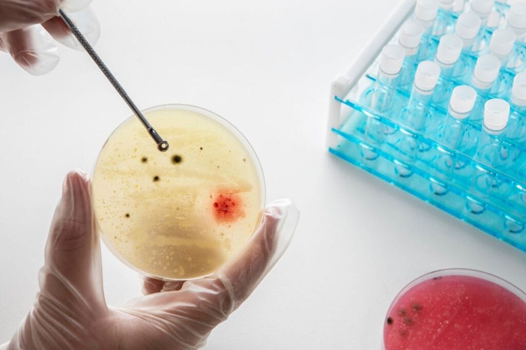 Qué significa una flora bacteriana muy abundante en orina